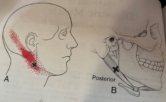 Is It TMJ Or Simply Your Digastric Muscle? - Health Tips From The Professor